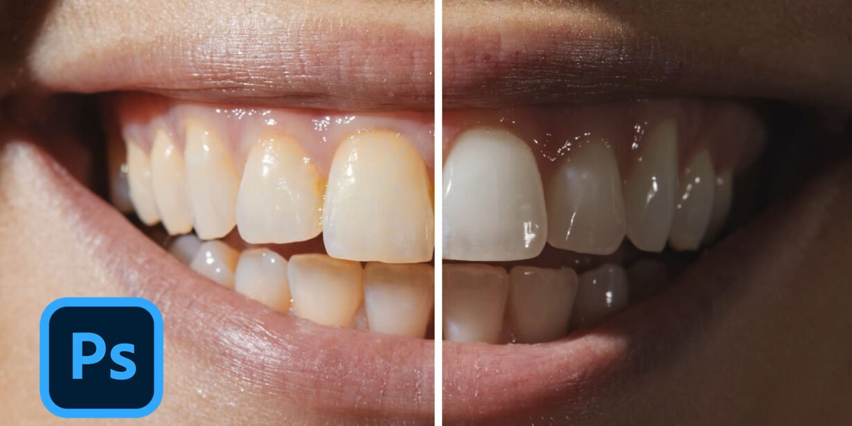 Whiten Teeth Naturally in Photoshop Tutorial (With Practice) | SellingsVibe