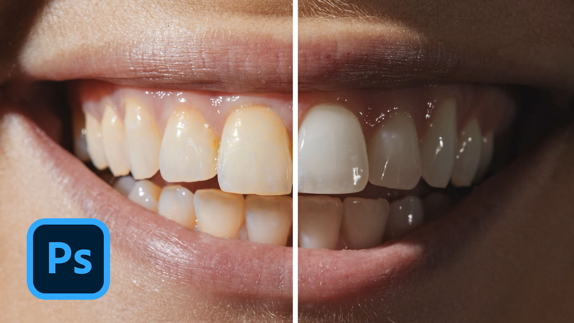 Whiten Teeth Naturally in Photoshop Tutorial (With Practice) | SellingsVibe